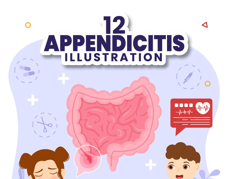 12 Appendicitis Inflammation Illustration - TemplateMonster