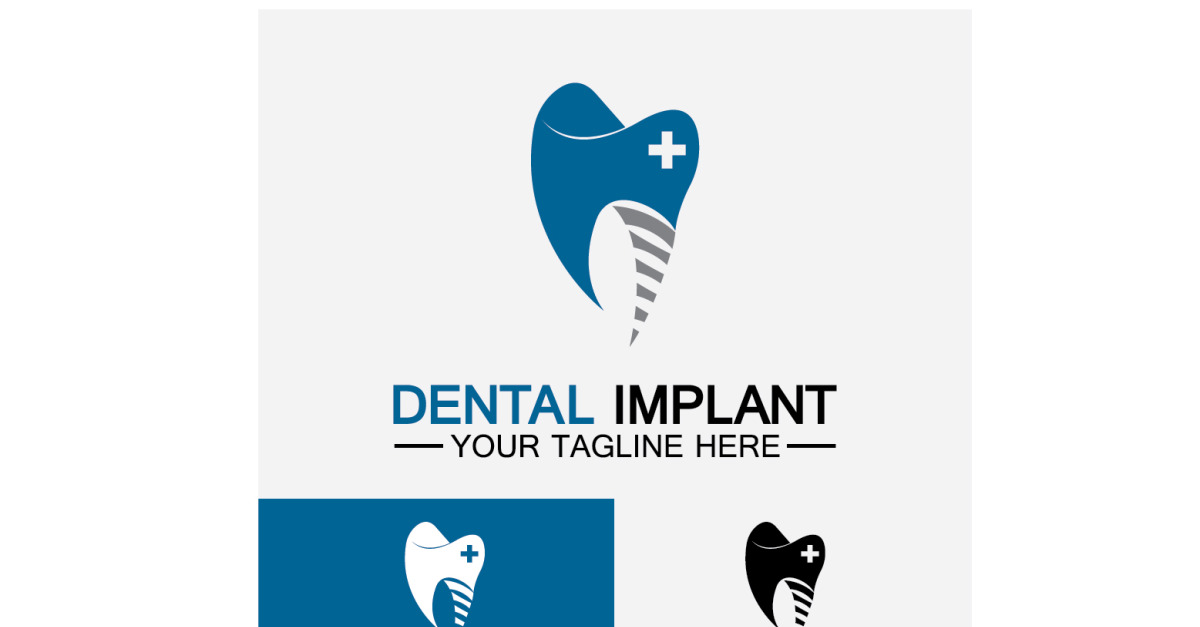 Modèle vectoriel de conception de logo dentairelogo de dentiste créatif ...