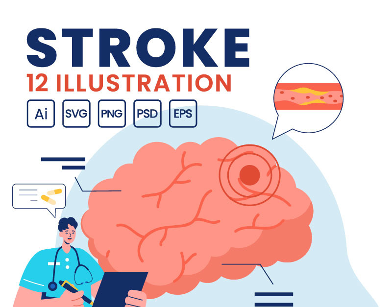 12 Human Brain Stroke Vector Illustration - TemplateMonster
