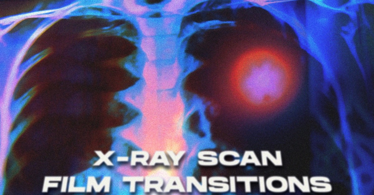 X-ray Scan Film Transitions | After Effects - TemplateMonster