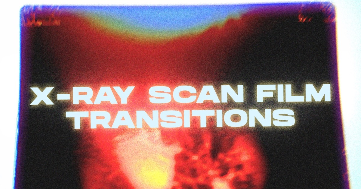 X-ray Scan Film Transitions #493419 - TemplateMonster