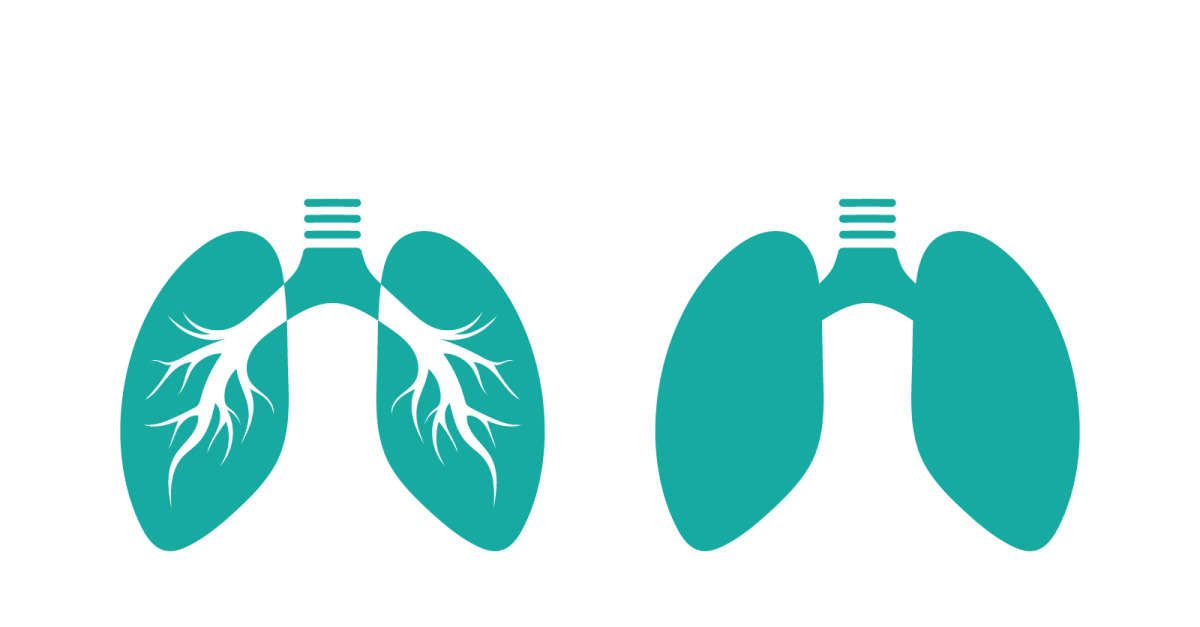 Lungen, medizinische, gesundheit, symbol, vektor, abbildung, design, v.4