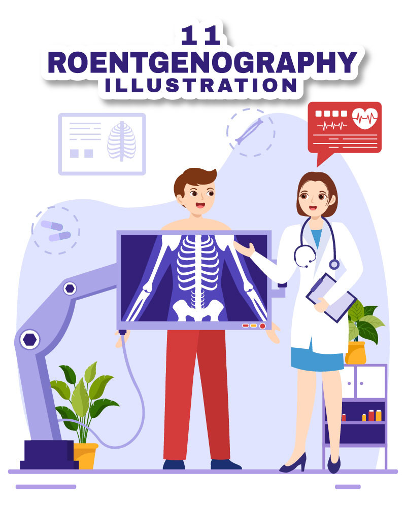 11 Roentgenography Vector Illustration - TemplateMonster