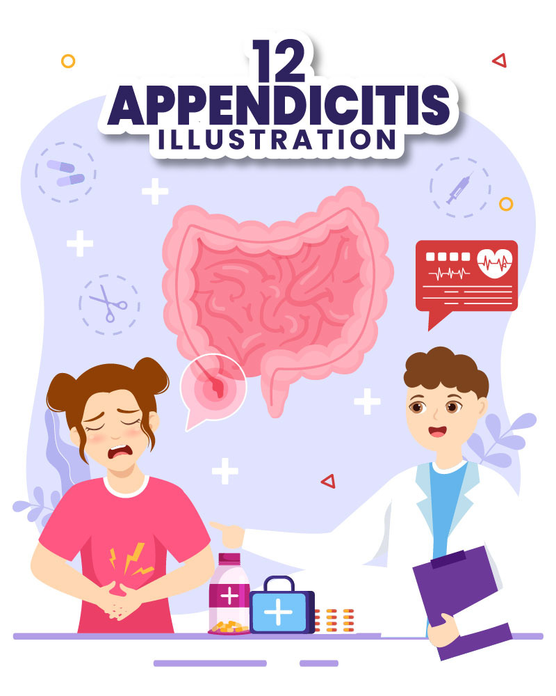 12 Appendicitis Inflammation Illustration - TemplateMonster