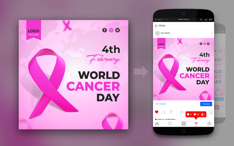 World Cancer Day 3D Pink Ribbon Social Media Post Design