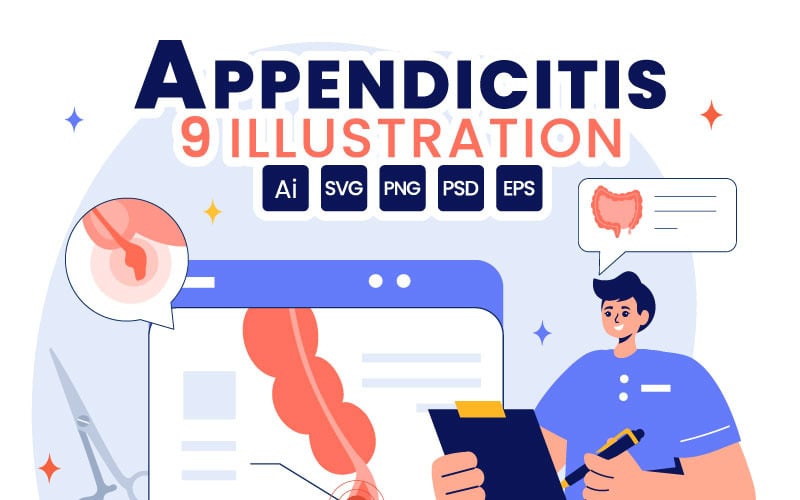 9 Appendicitis Inflammation Illustration - TemplateMonster